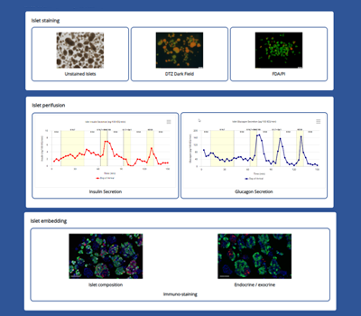 Integrated Islet Distribution Program IIDP Human Islets for Research ...